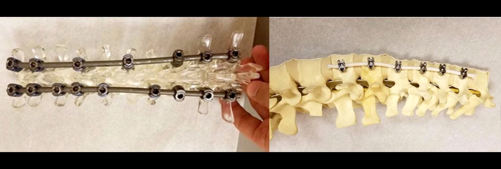 Physician Assistants in Orthopaedic Surgery