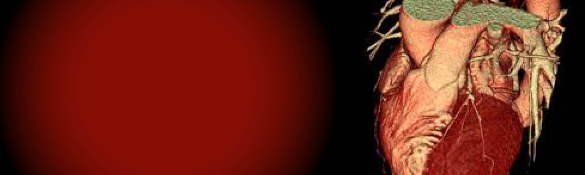 Society of Cardiovascular Computed Tomography