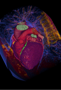 Education and Meetings Landing Page - Society of Cardiovascular ...