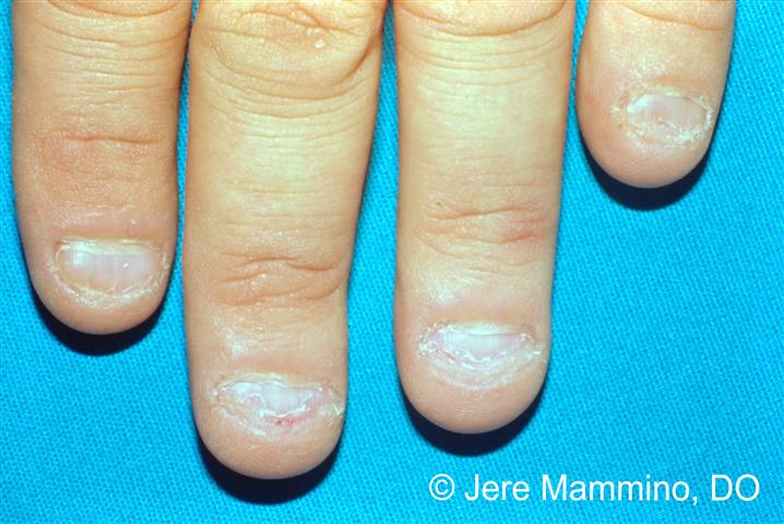 Best type of nails on a foid | Incels.is - Involuntary Celibate Forum